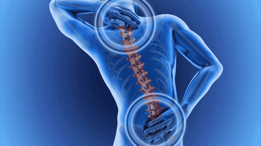 Post-Laminectomy Syndrome: Interventional Solutions for Persistent Back ...